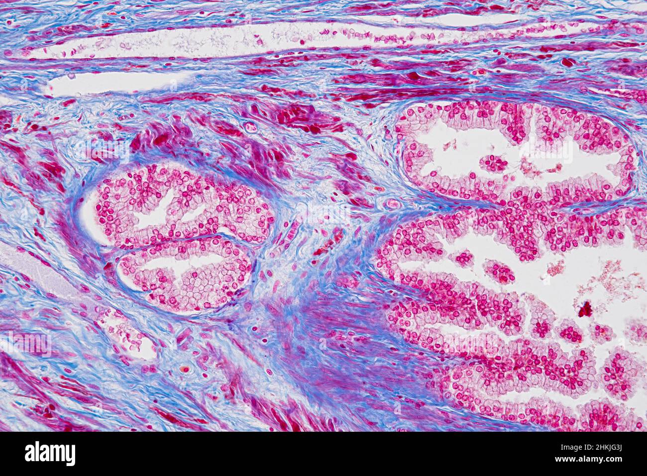 Prostate gland, light micrograph Stock Photo - Alamy