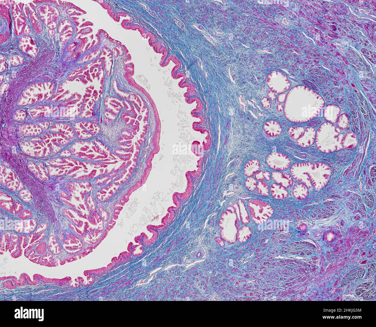 Prostate gland and urethra, light micrograph Stock Photo - Alamy