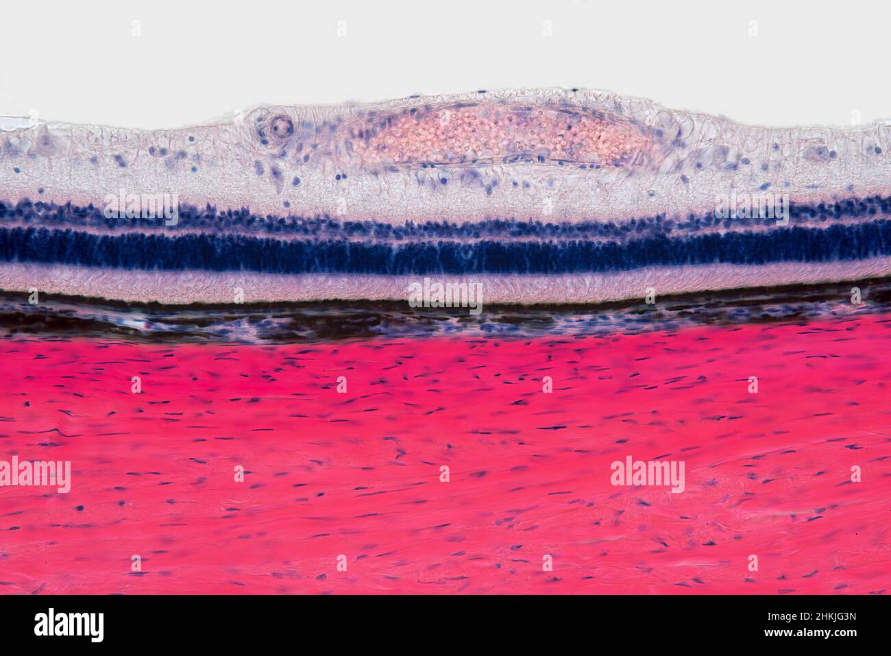 Retina, light micrograph Stock Photo - Alamy