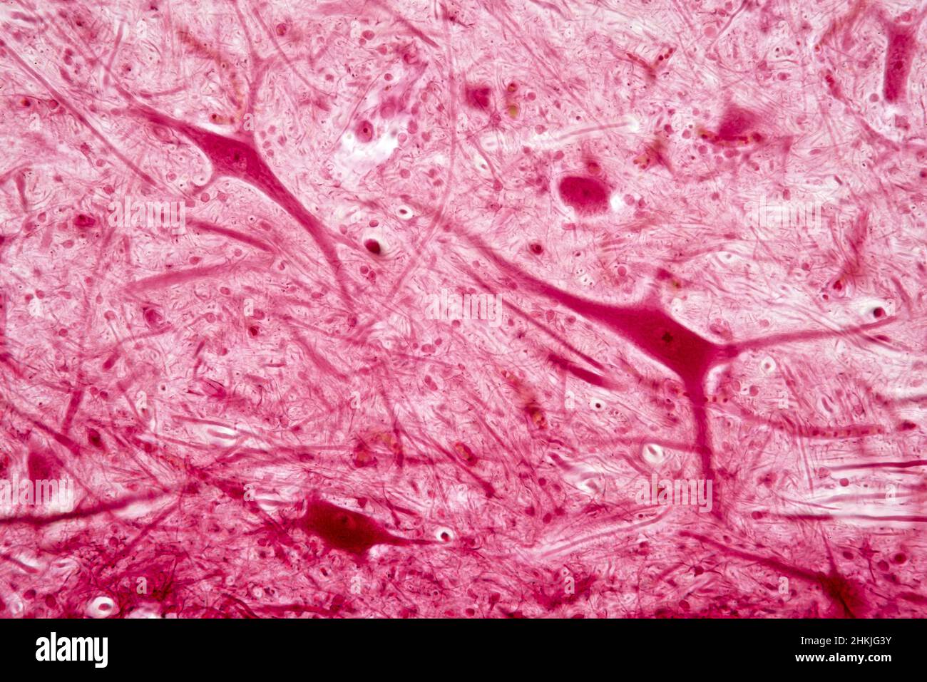 Spinal cord, light micrograph Stock Photo - Alamy Spinal cord, light micrograph Stock Photo - Alamy