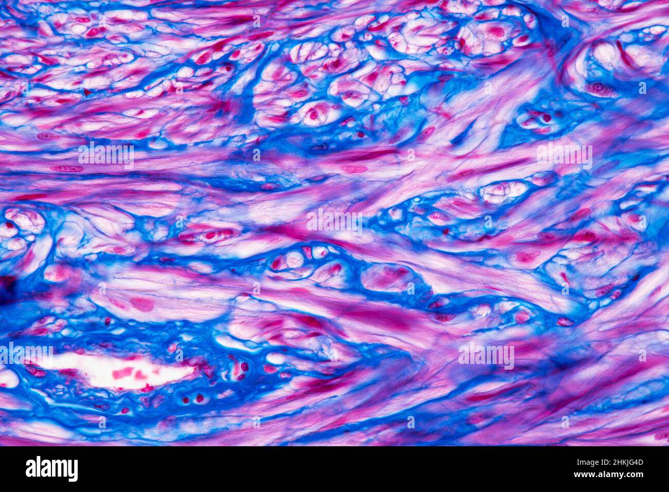 Vas deferens, light micrograph Stock Photo - Alamy