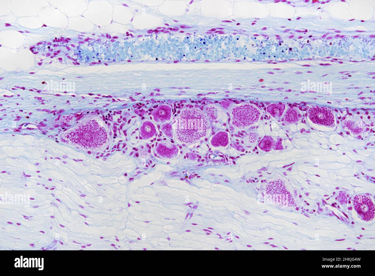 Spinal sensory ganglion, light micrograph Stock Photo - Alamy