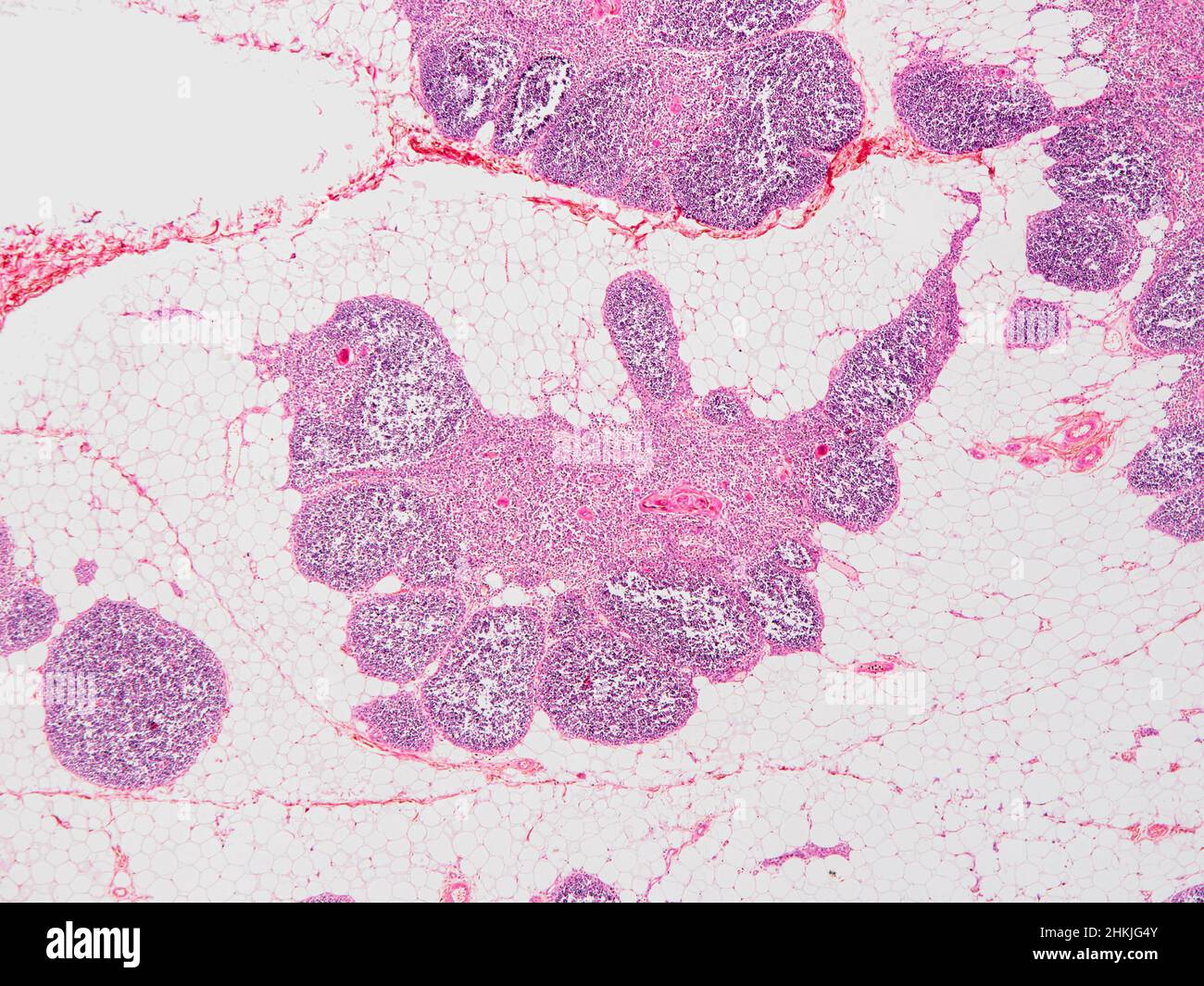 Thymus gland, light micrograph Stock Photo - Alamy
