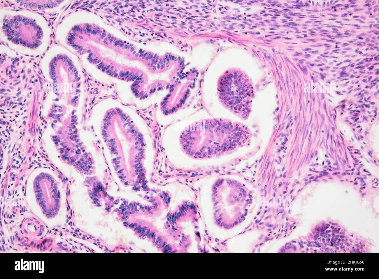 Uterus lining, light micrograph Stock Photo - Alamy