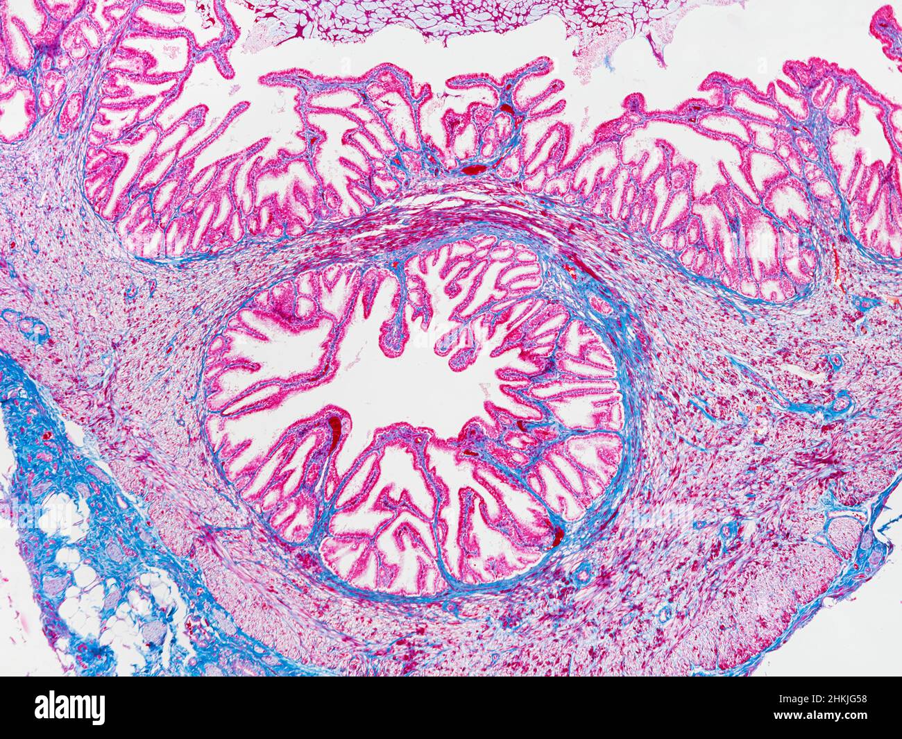 Seminal vesicle, light micrograph Stock Photo - Alamy