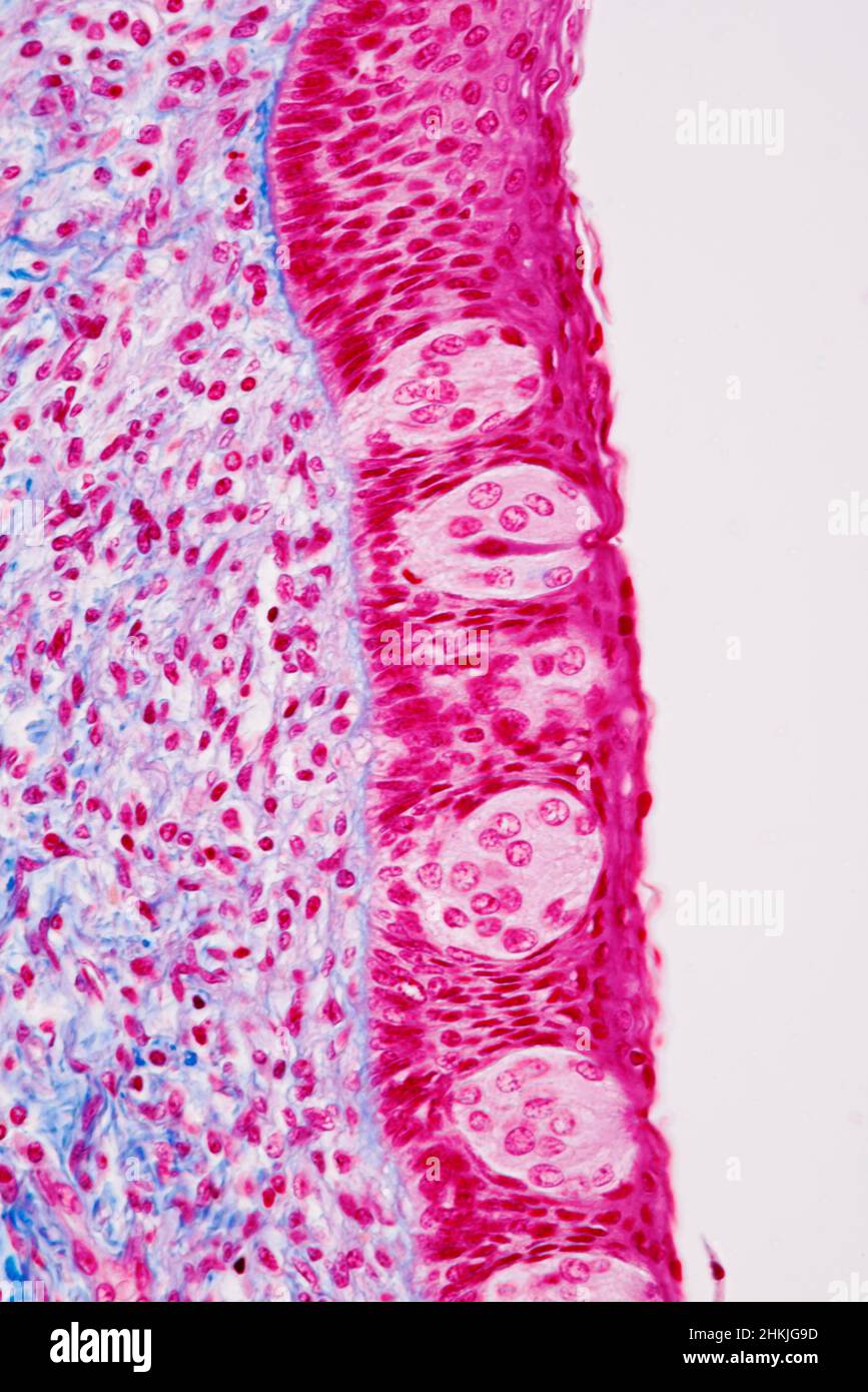 Taste buds, light micrograph Stock Photo - Alamy