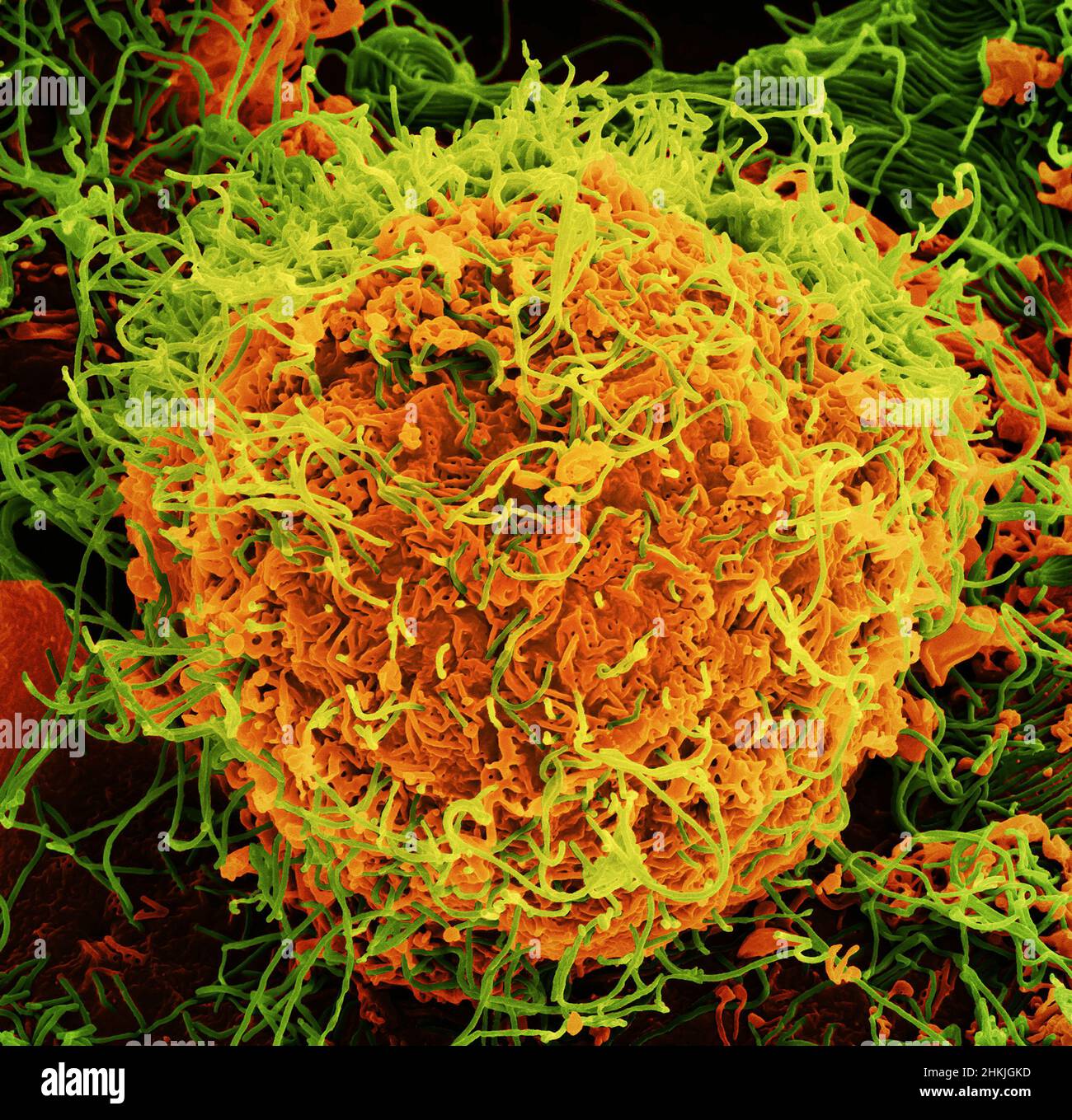 Ebola virus particles, SEM Stock Photo - Alamy