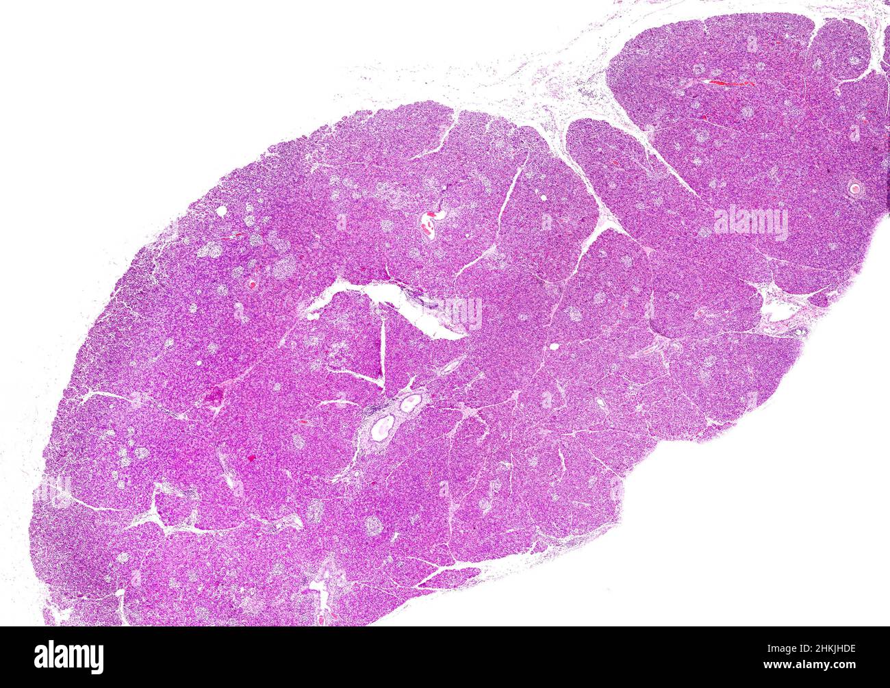Pancreas, light micrograph Stock Photo - Alamy