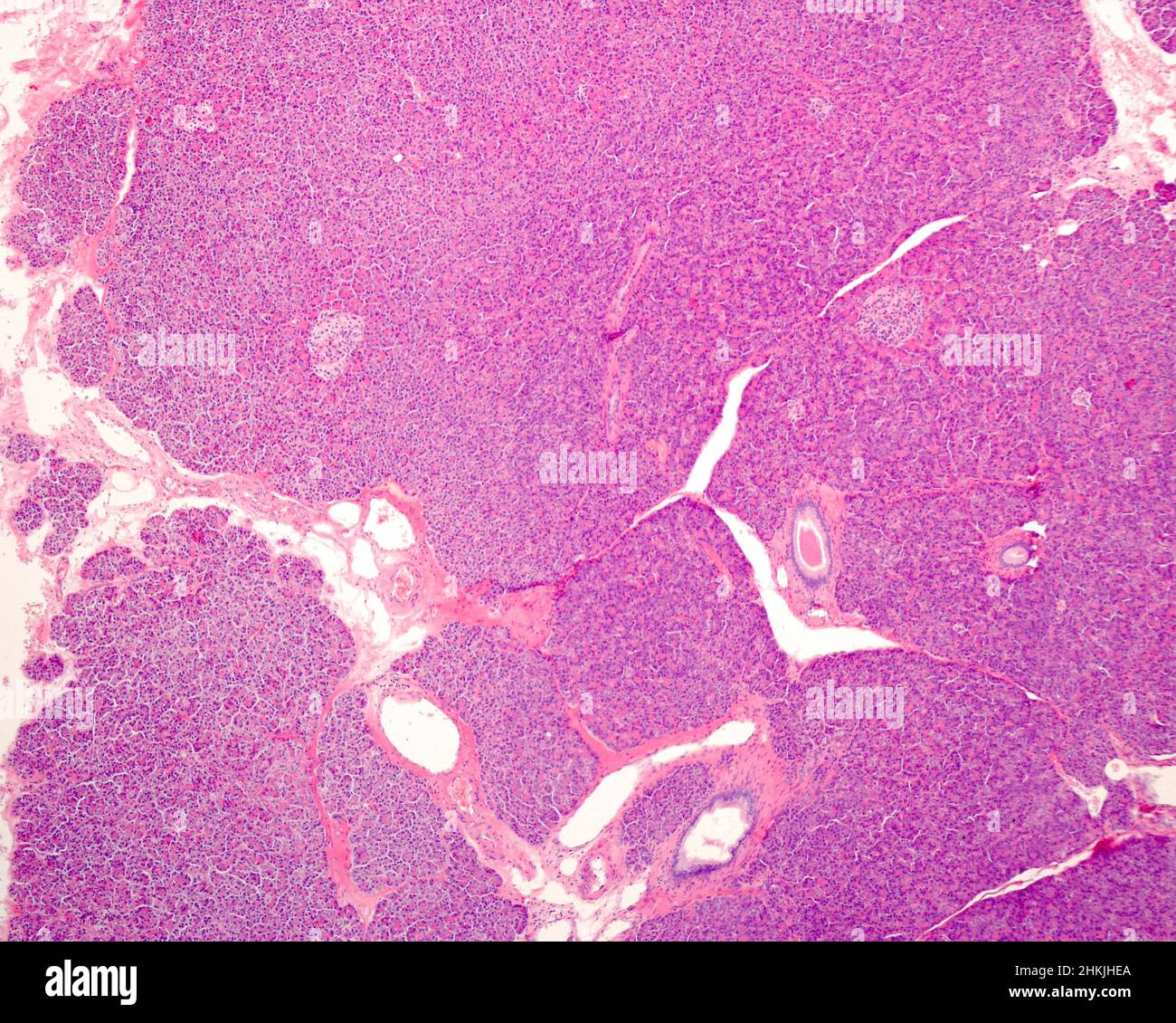 Pancreas, light micrograph Stock Photo - Alamy