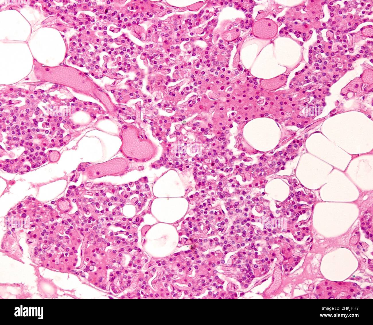 Parathyroid gland, light micrograph Stock Photo - Alamy