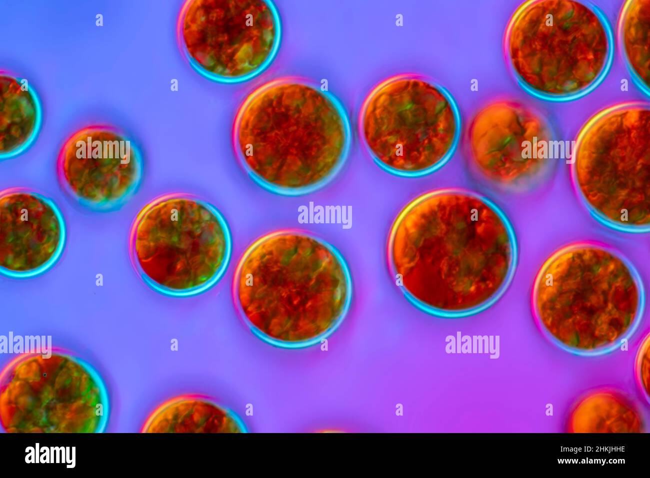 Haematococcus sp. green algae, light micrograph Stock Photo - Alamy