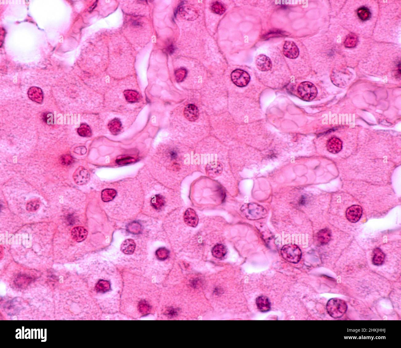 Parathyroid gland, light micrograph Stock Photo - Alamy