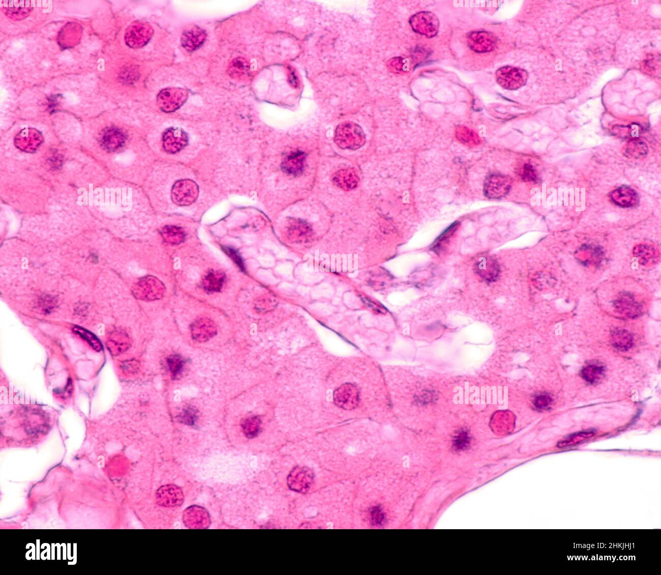Parathyroid gland, light micrograph Stock Photo - Alamy