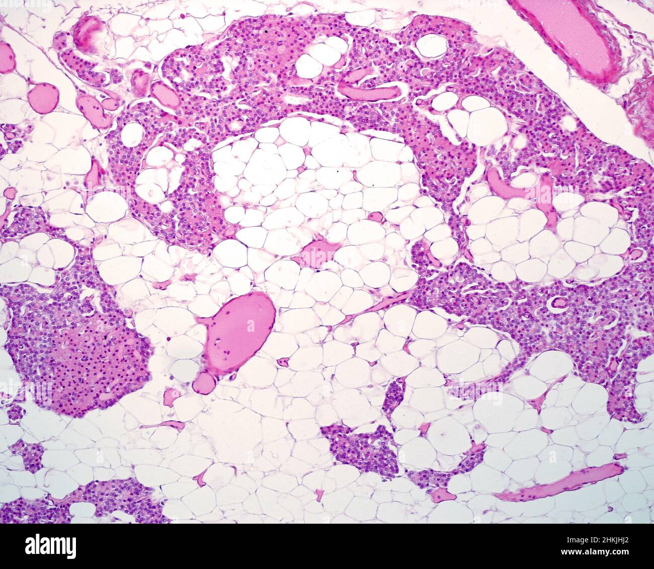 Adult parathyroid gland, light micrograph Stock Photo - Alamy
