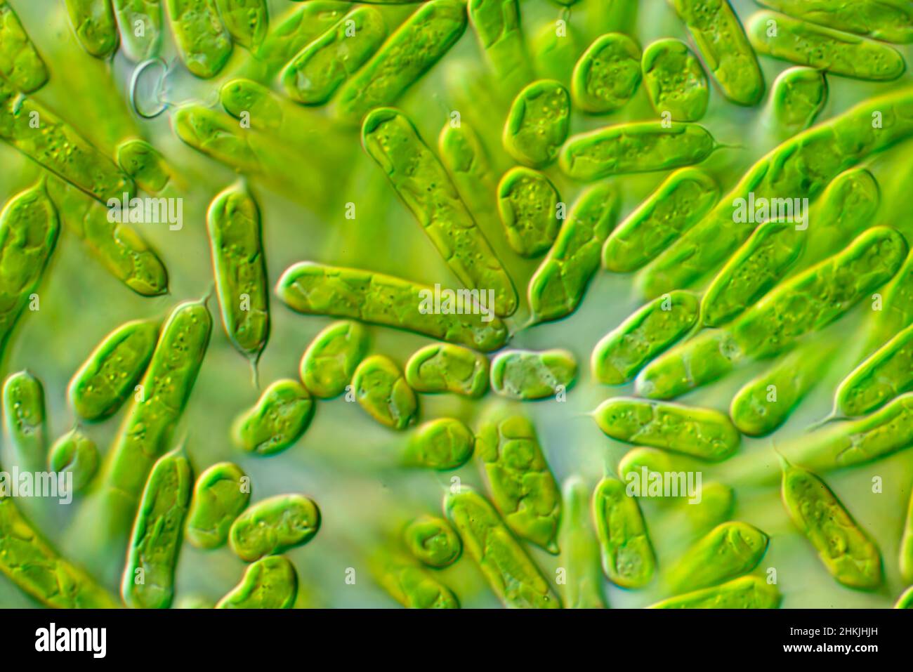 Ophiocytium sp., green algae, light micrograph Stock Photo - Alamy
