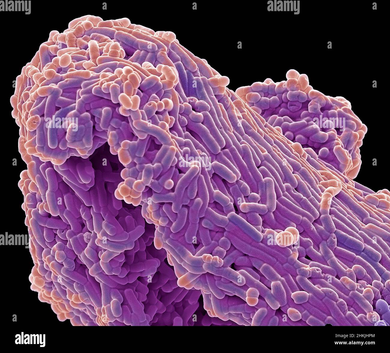 Skin bacteria, SEM Stock Photo - Alamy