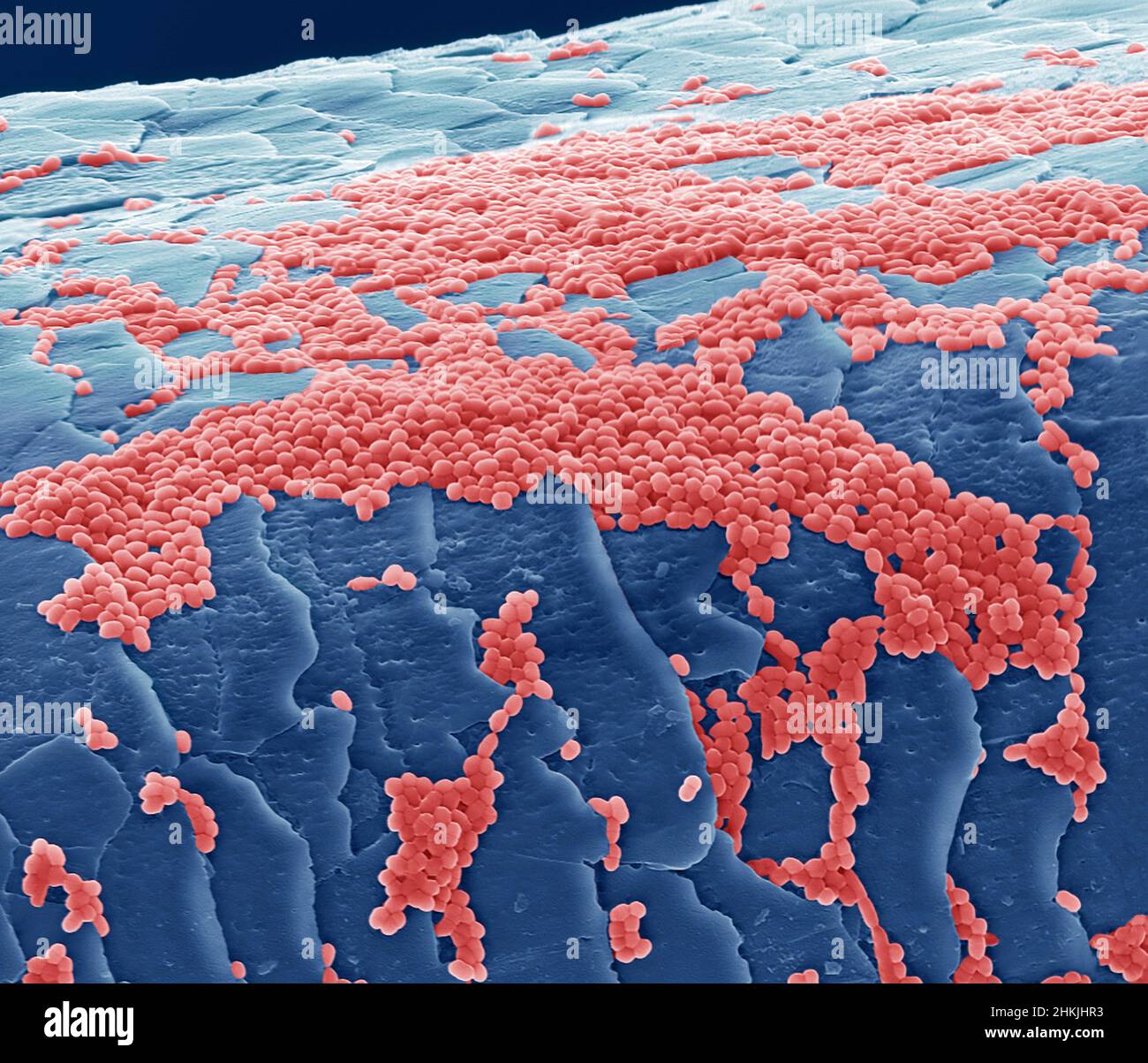 Skin bacteria on hair, SEM Stock Photo - Alamy