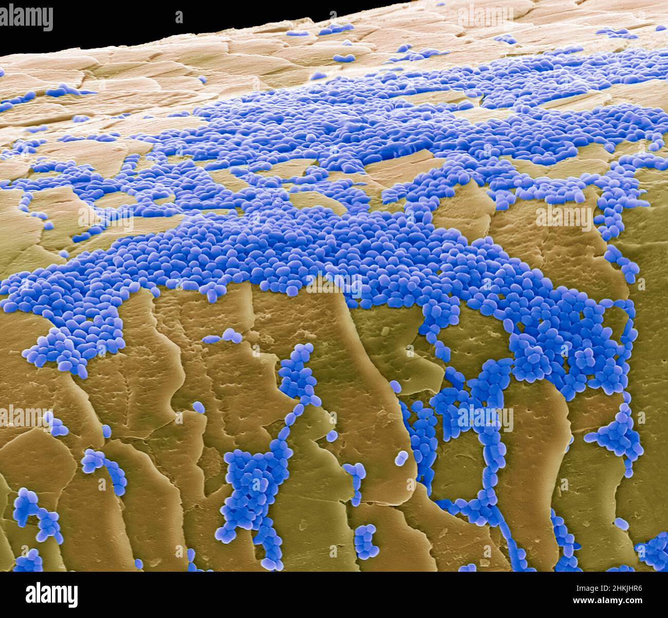 Skin bacteria on hair, SEM Stock Photo - Alamy