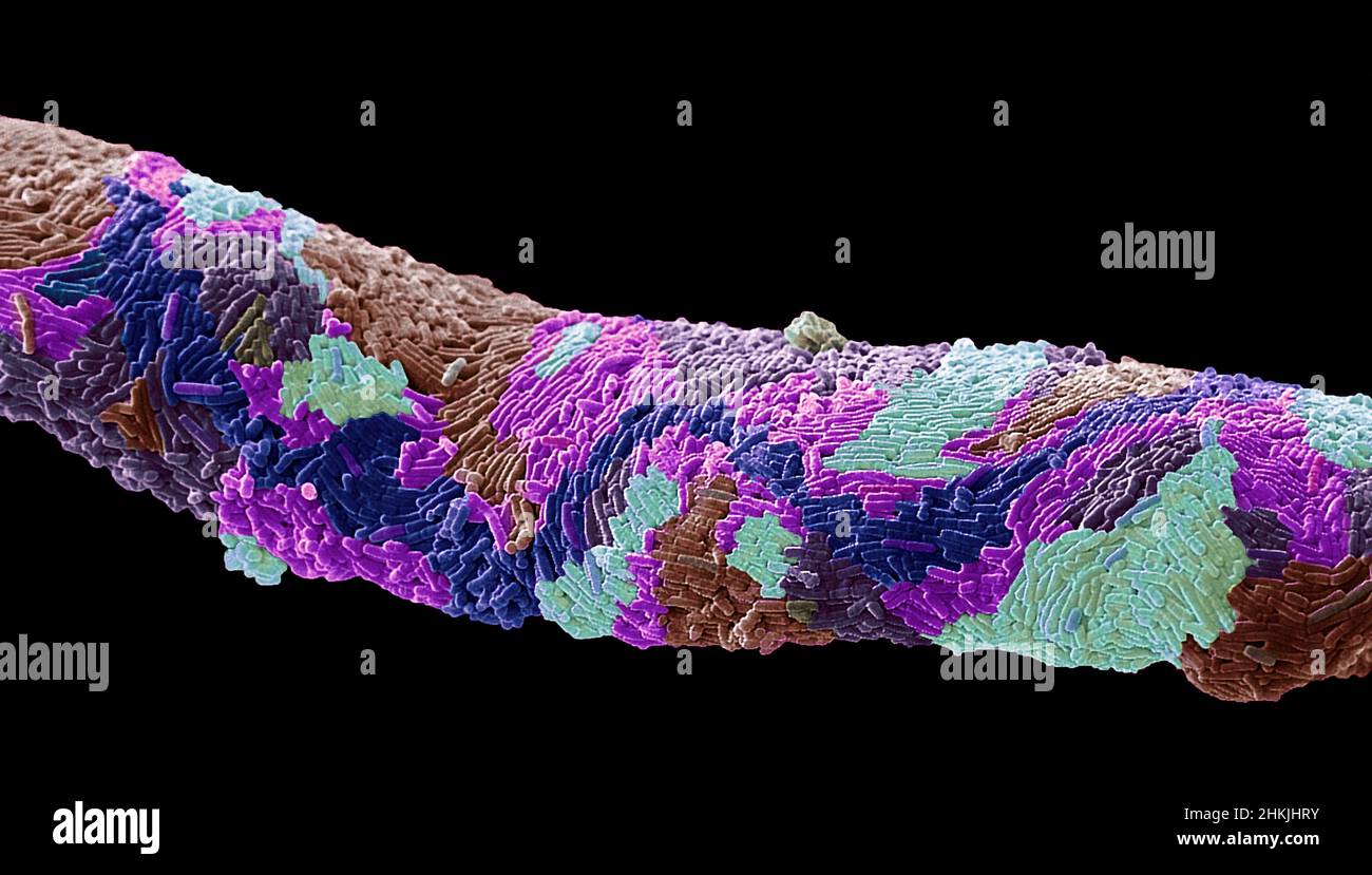 Skin bacteria, SEM Stock Photo - Alamy