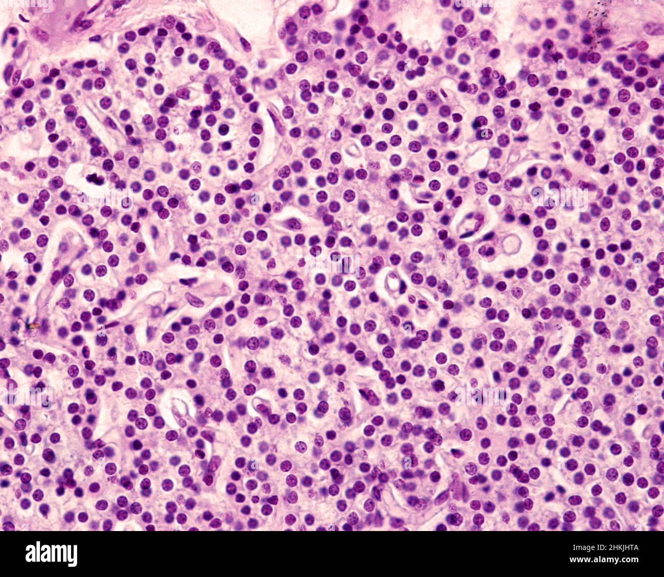 Child parathyroid gland, light micrograph Stock Photo - Alamy