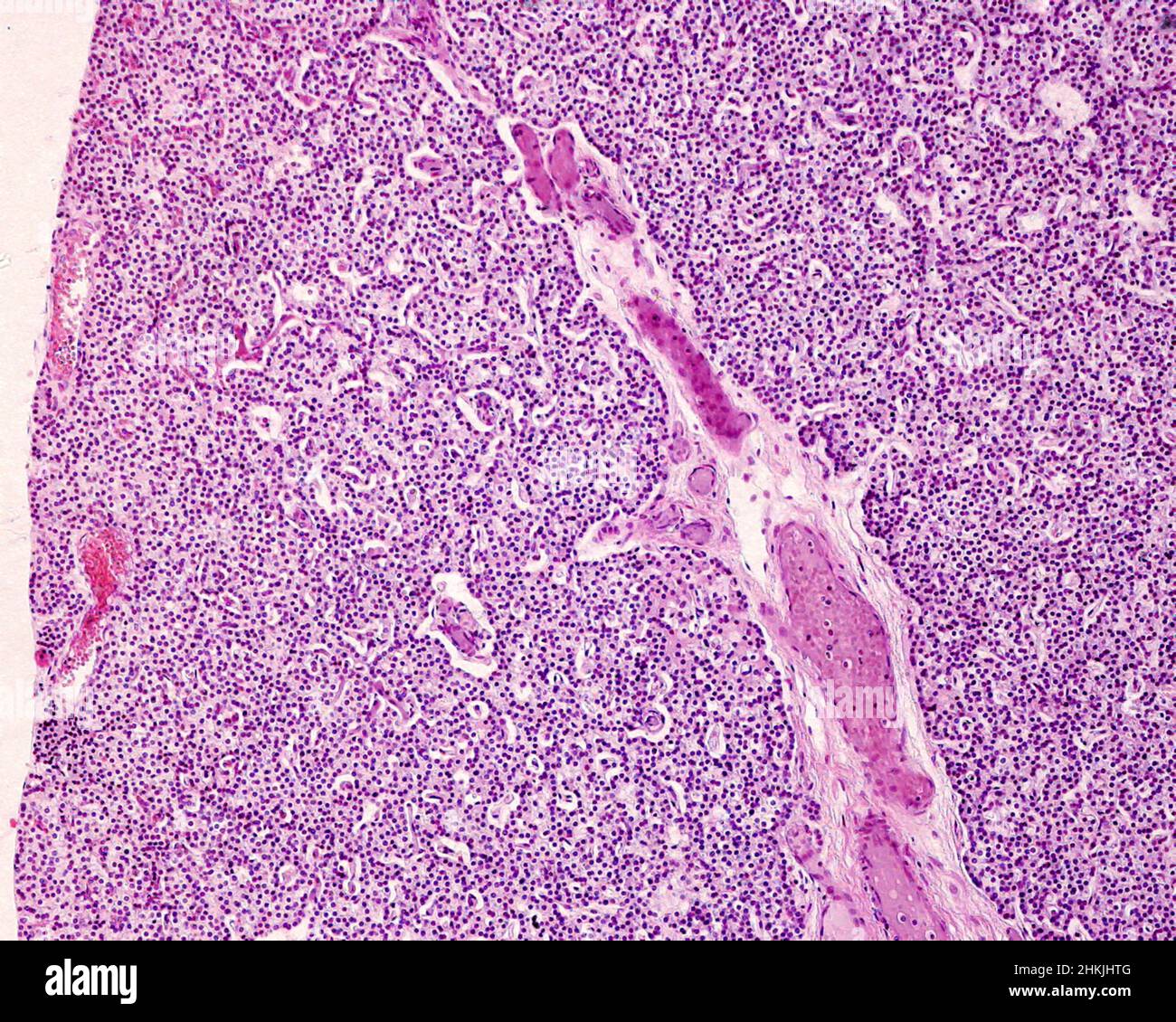 Parathyroid gland of a child, light micrograph Stock Photo - Alamy