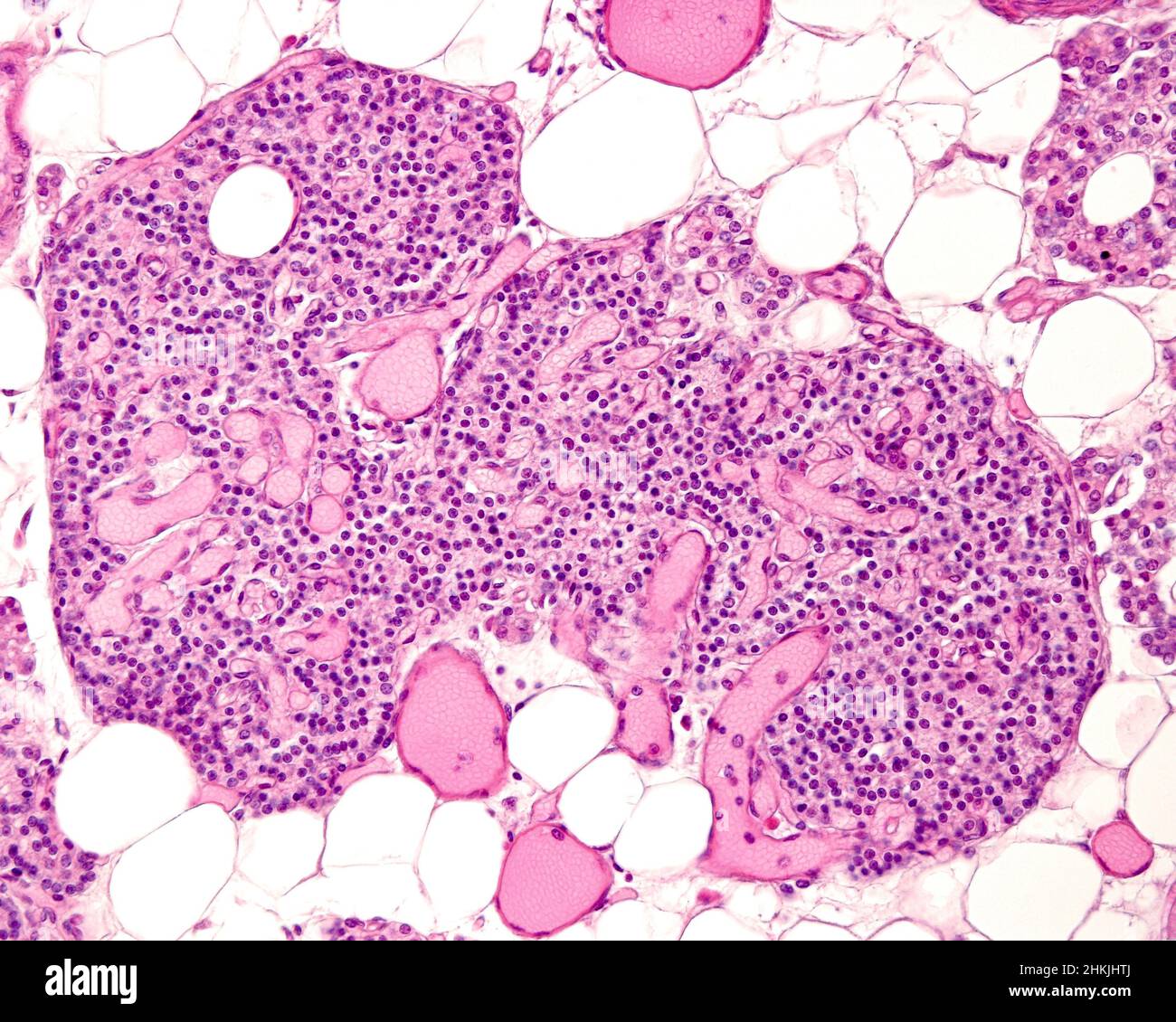 Parathyroid gland, light micrograph Stock Photo - Alamy