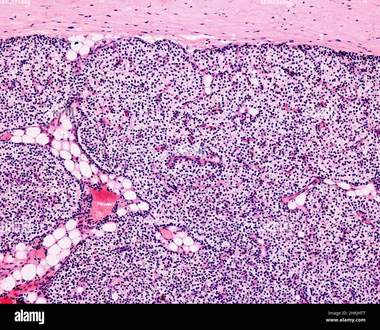 Child parathyroid gland, light micrograph Stock Photo - Alamy