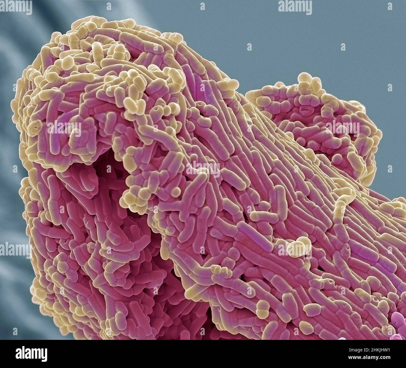 Skin bacteria, SEM Stock Photo - Alamy