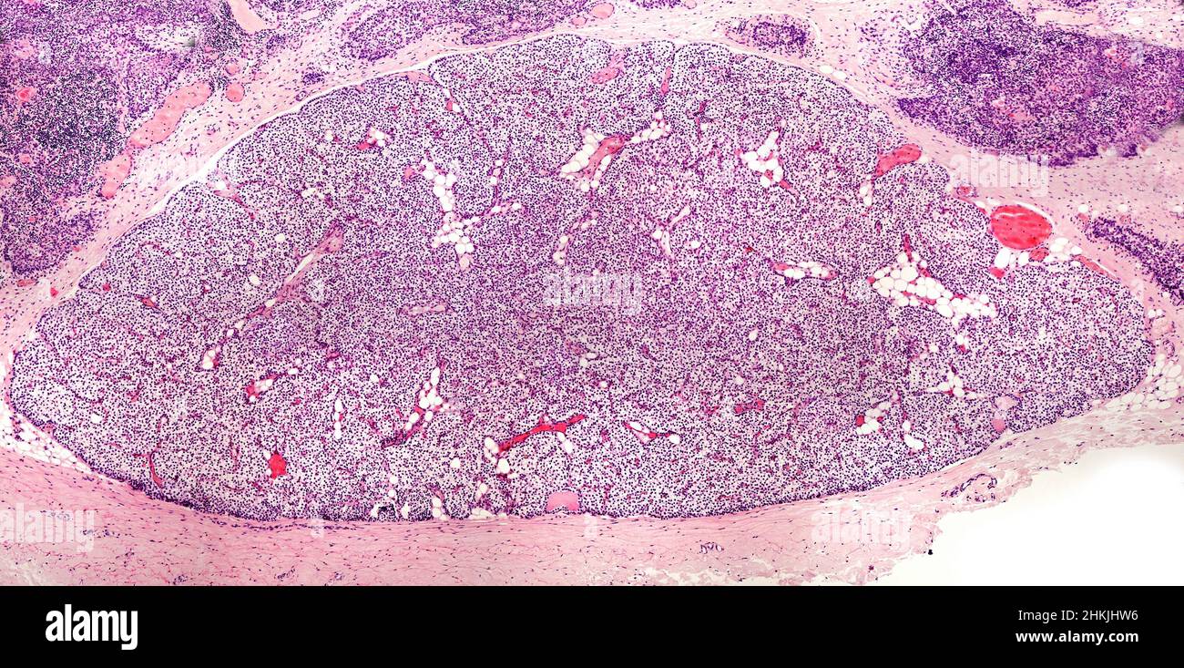 Parathyroid, light micrograph Stock Photo - Alamy