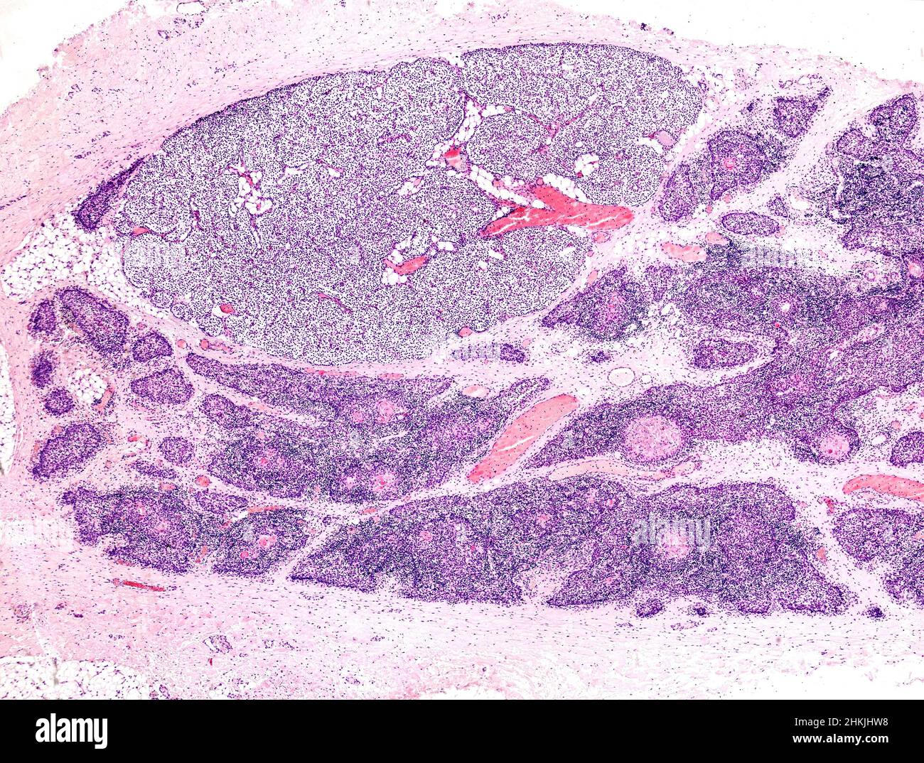 Parathyroid gland of a child, light micrograph Stock Photo - Alamy