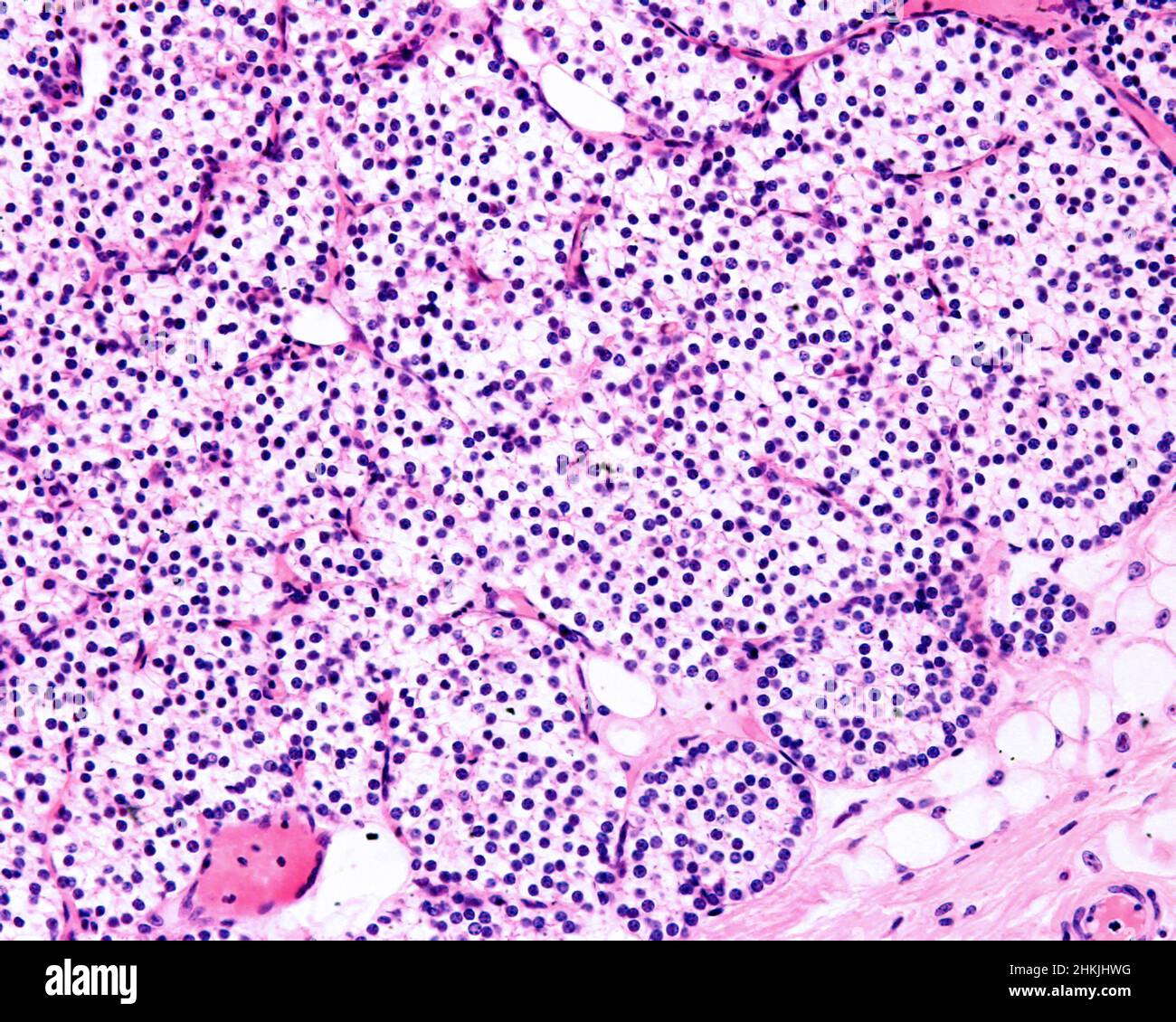 Parathyroid gland, light micrograph Stock Photo - Alamy