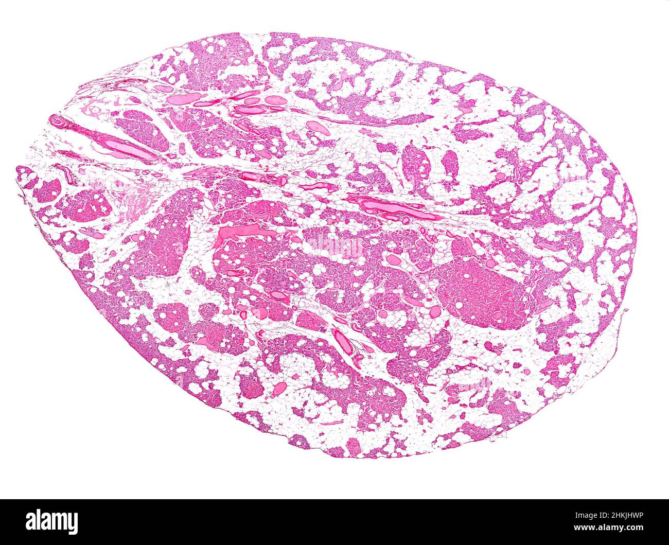 Parathyroid gland of an elderly adult, light micrograph Stock Photo - Alamy