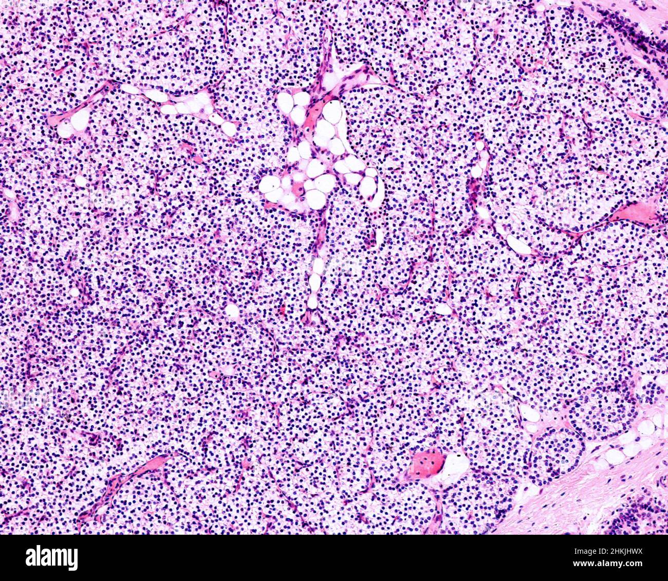 Parathyroid gland of a child, light micrograph Stock Photo - Alamy