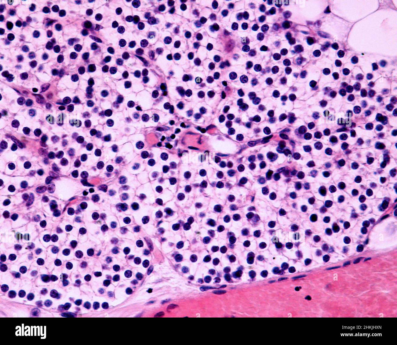 Parathyroid gland of a child, light micrograph Stock Photo - Alamy