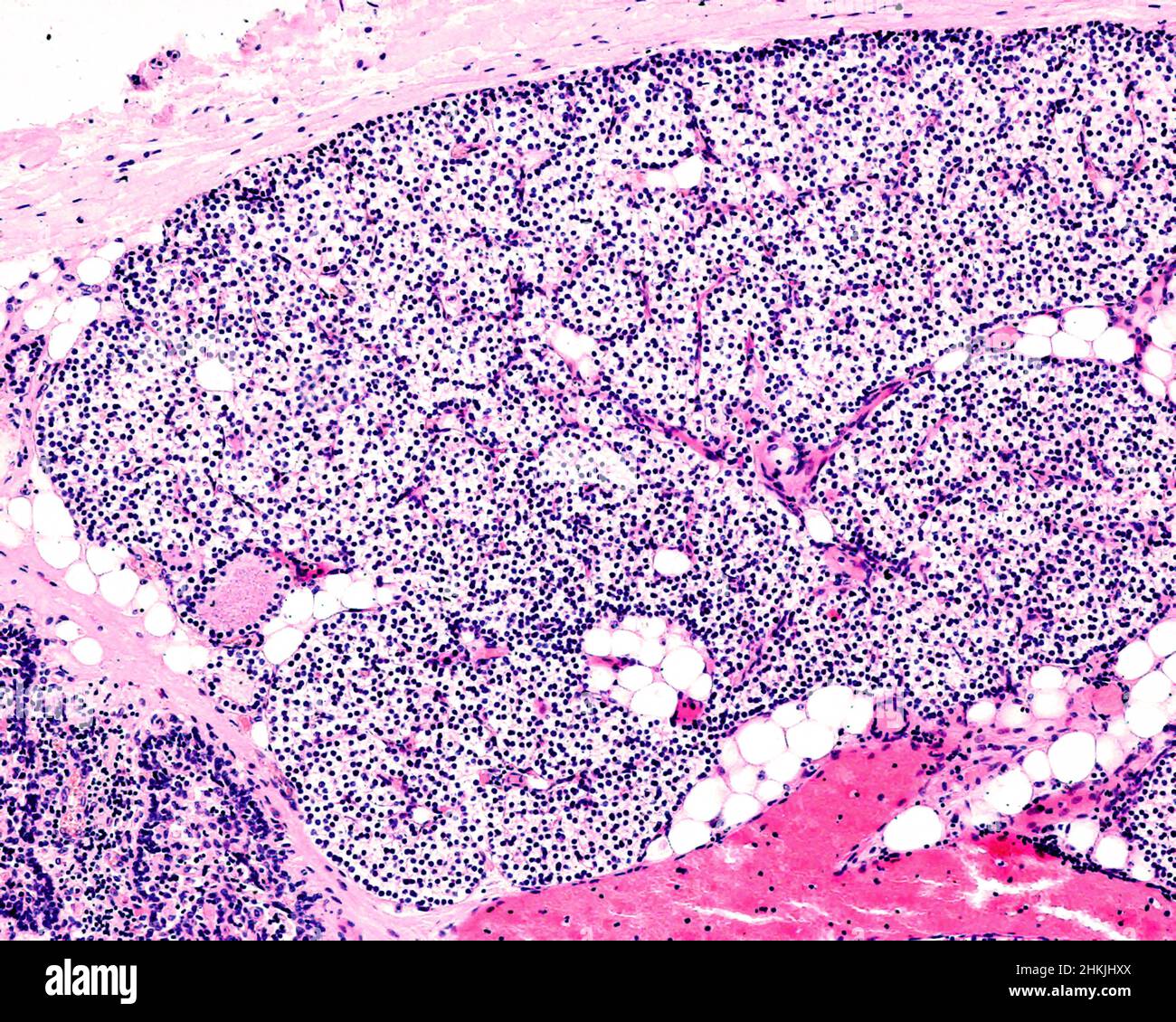 Parathyroid gland of a child, light micrograph Stock Photo - Alamy