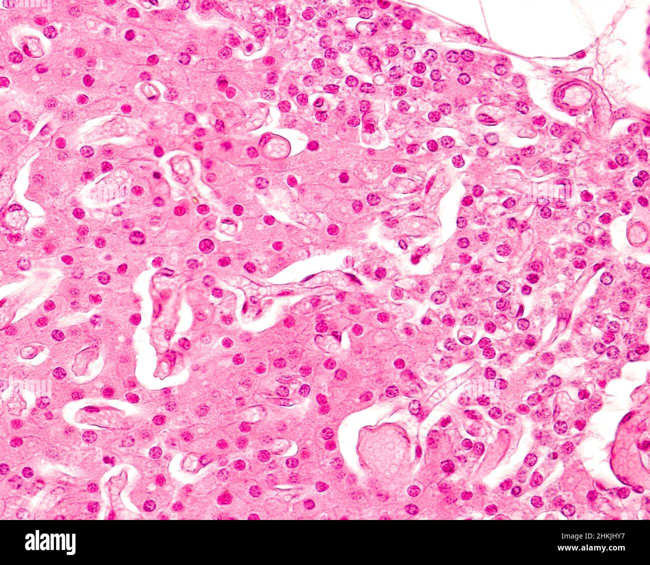 Parathyroid gland, light micrograph Stock Photo - Alamy