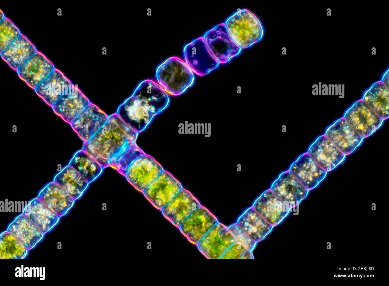 Hyalotheca green algae, light micrograph Stock Photo - Alamy