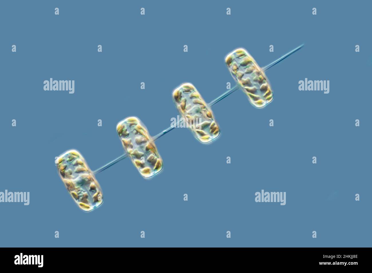 Thalassiosira diatoms, light micrograph Stock Photo - Alamy