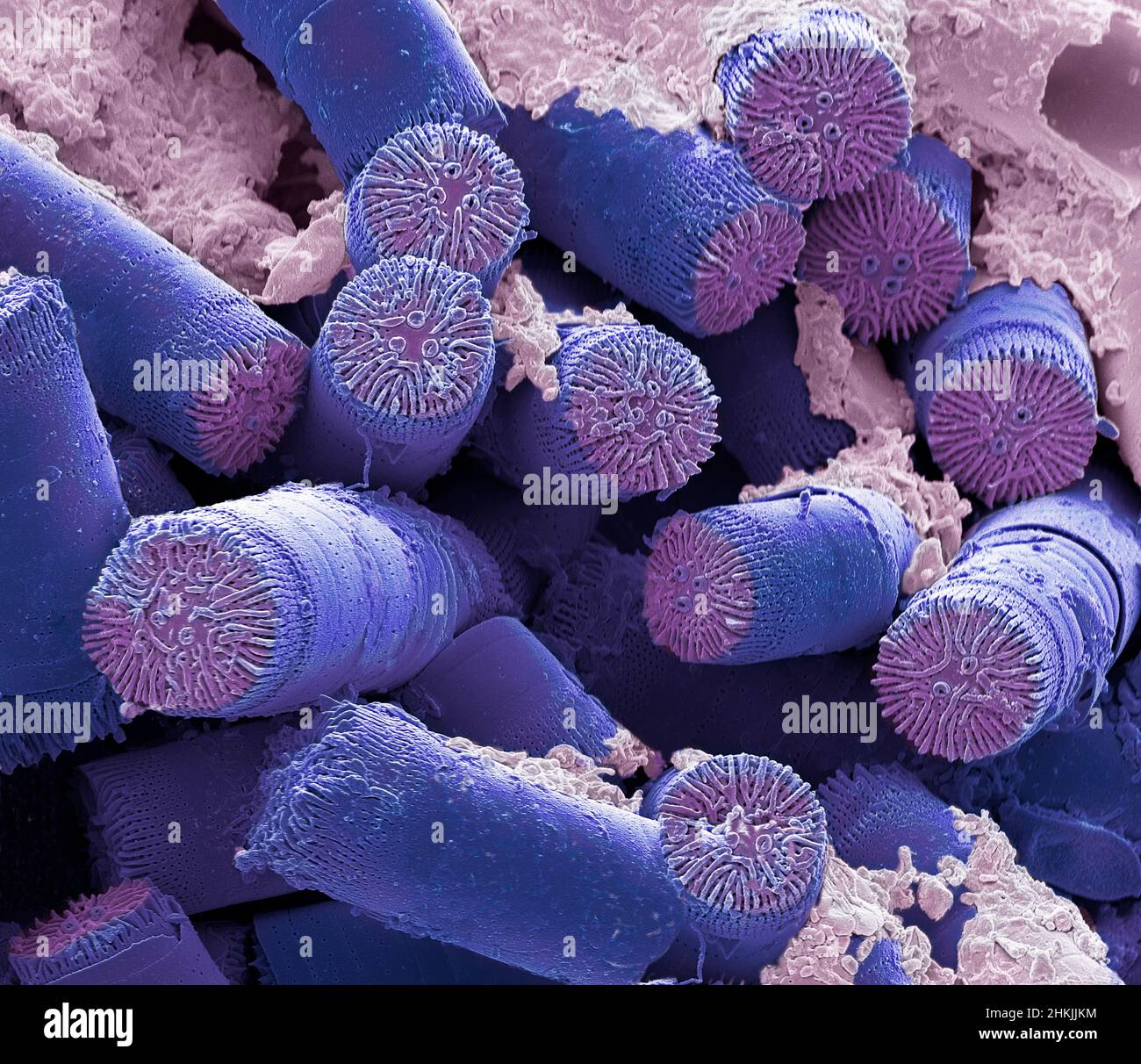 Soil diatoms, SEM Stock Photo - Alamy
