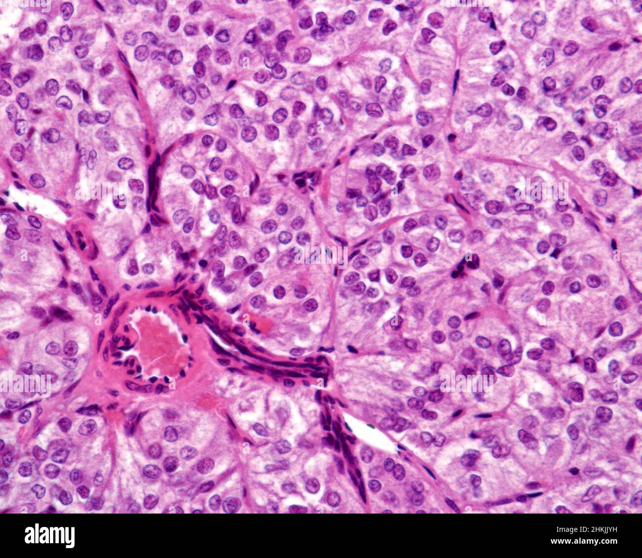Human adrenal gland medulla, light micrograph Stock Photo - Alamy