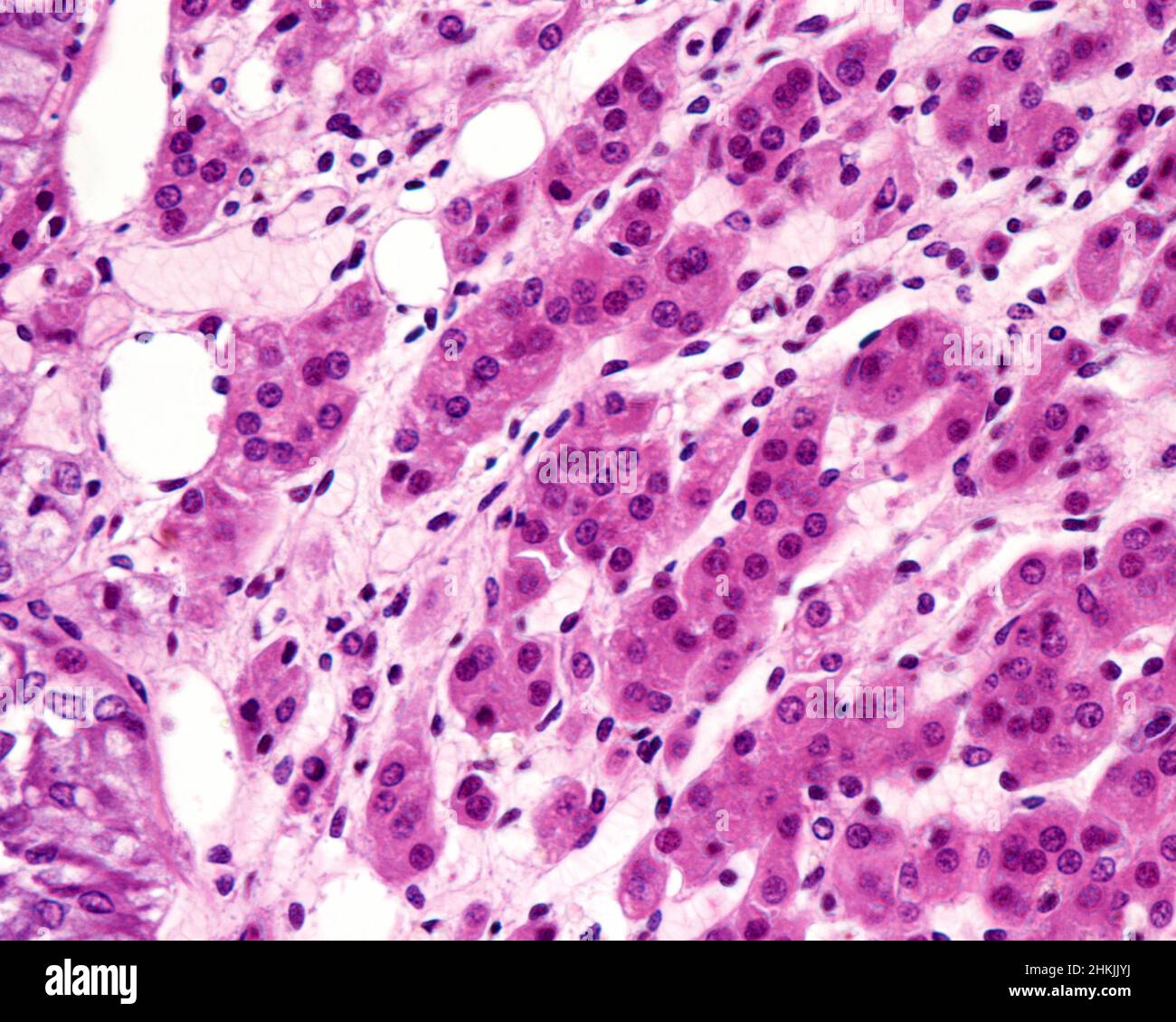 Human adrenal gland cortex, light micrograph Stock Photo - Alamy