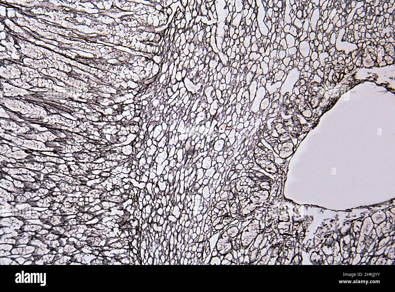 Human adrenal gland cortex and medulla, light micrograph Stock Photo ...