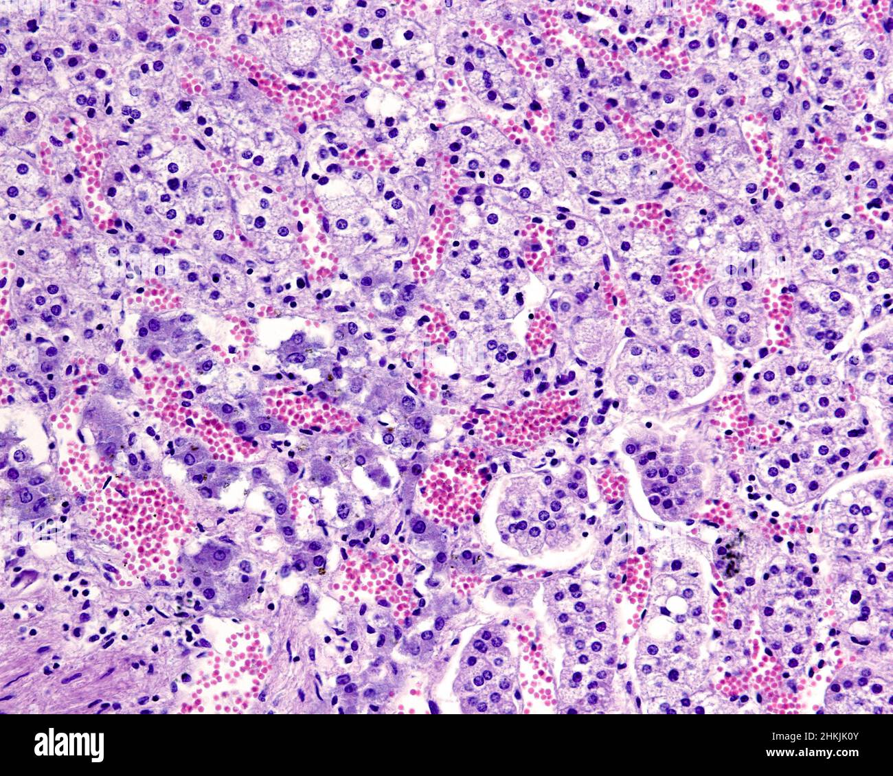 Boundary of cortex and adrenal medulla, light micrograph Stock Photo ...