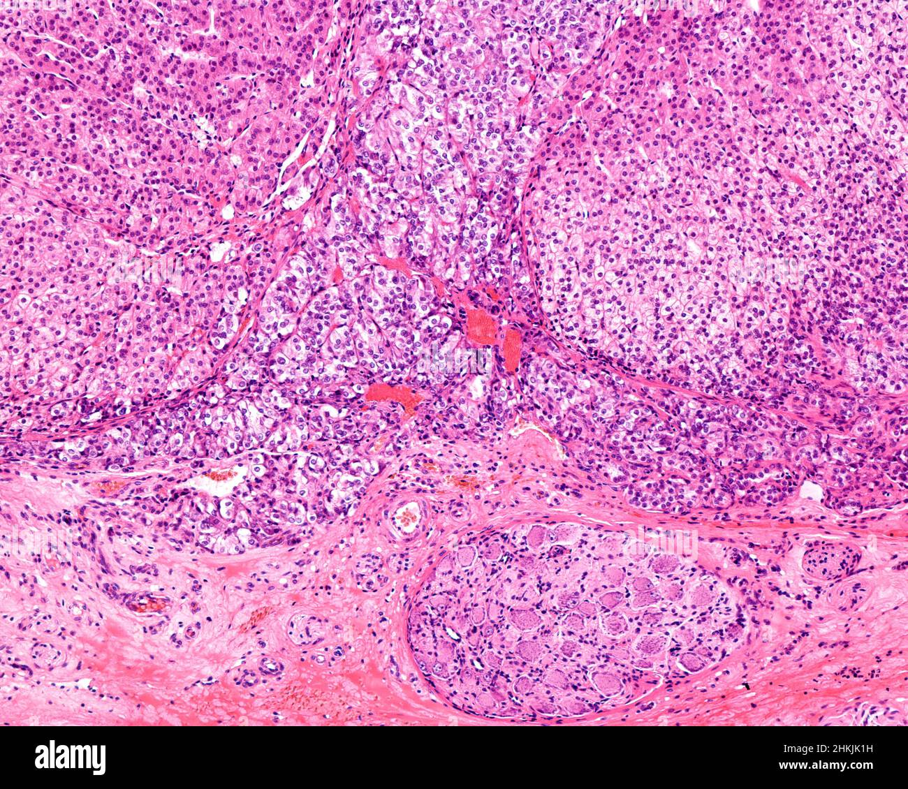 Autonomic nerve ganglion, light micrograph Stock Photo - Alamy