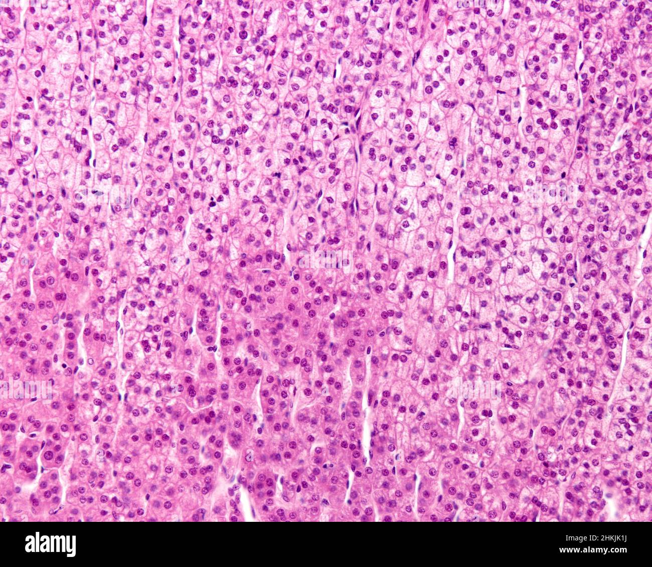 Human adrenal gland, light micrograph Stock Photo - Alamy