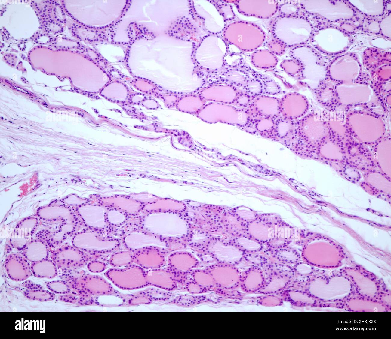 Human thyroid gland, light micrograph Stock Photo - Alamy