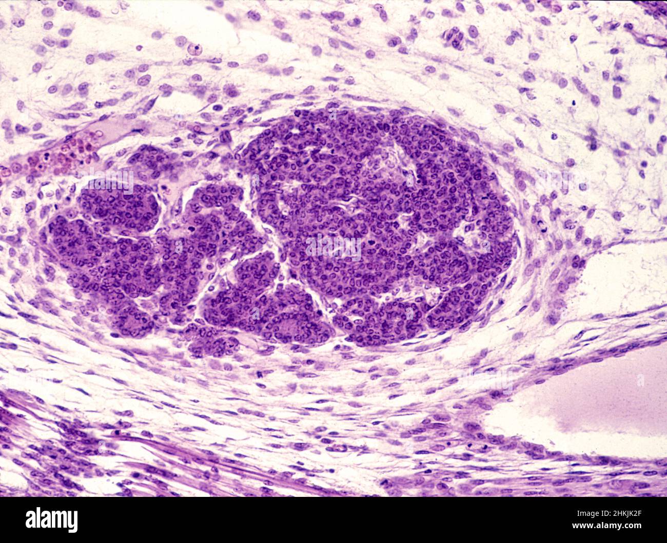 Development of the thyroid gland, light micrograph Stock Photo - Alamy