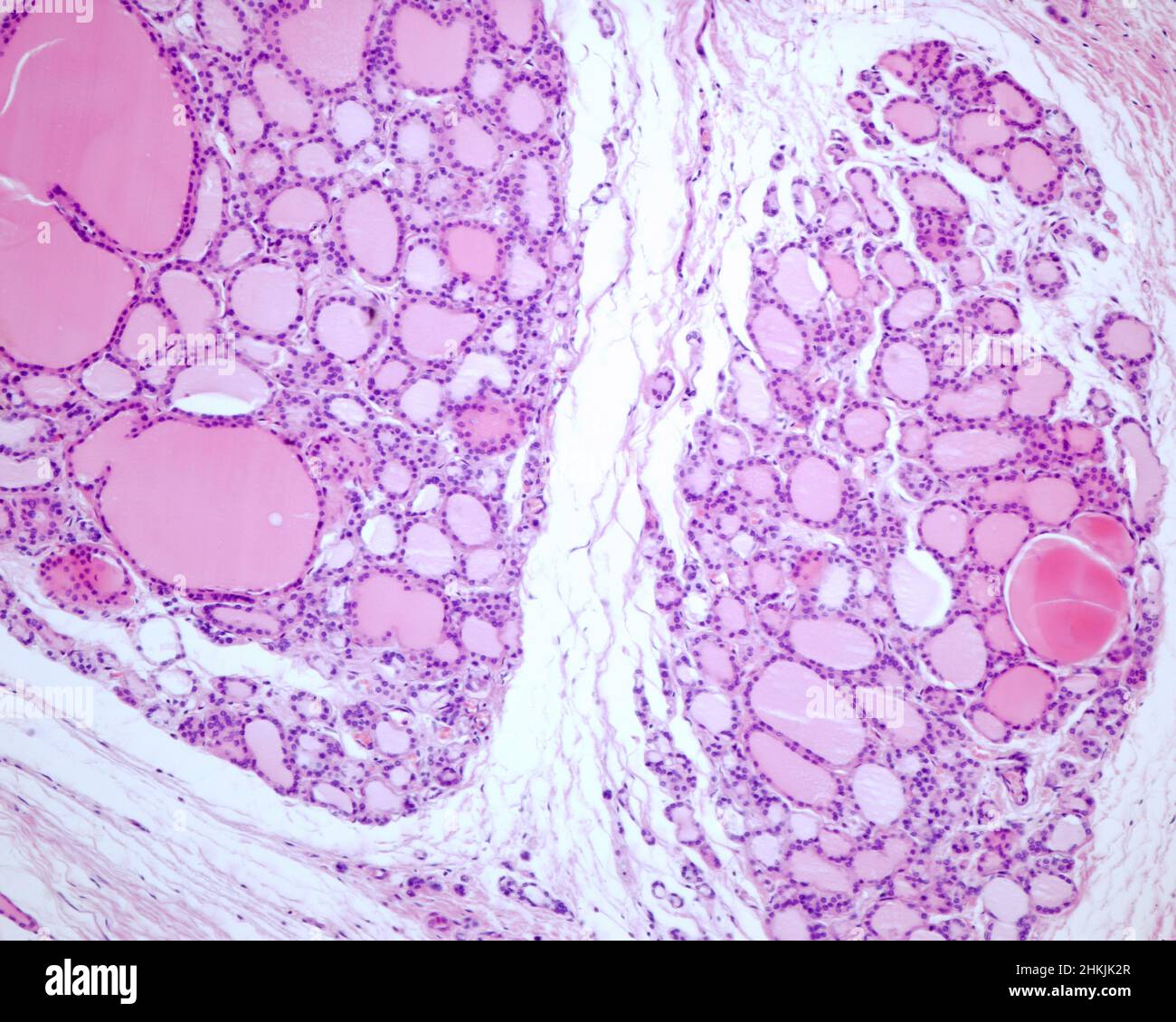 Human thyroid gland, light micrograph Stock Photo - Alamy