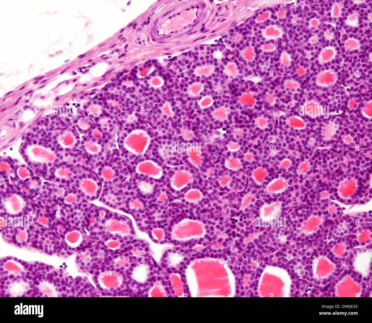 Thyroid gland capsule, light micrograph Stock Photo - Alamy