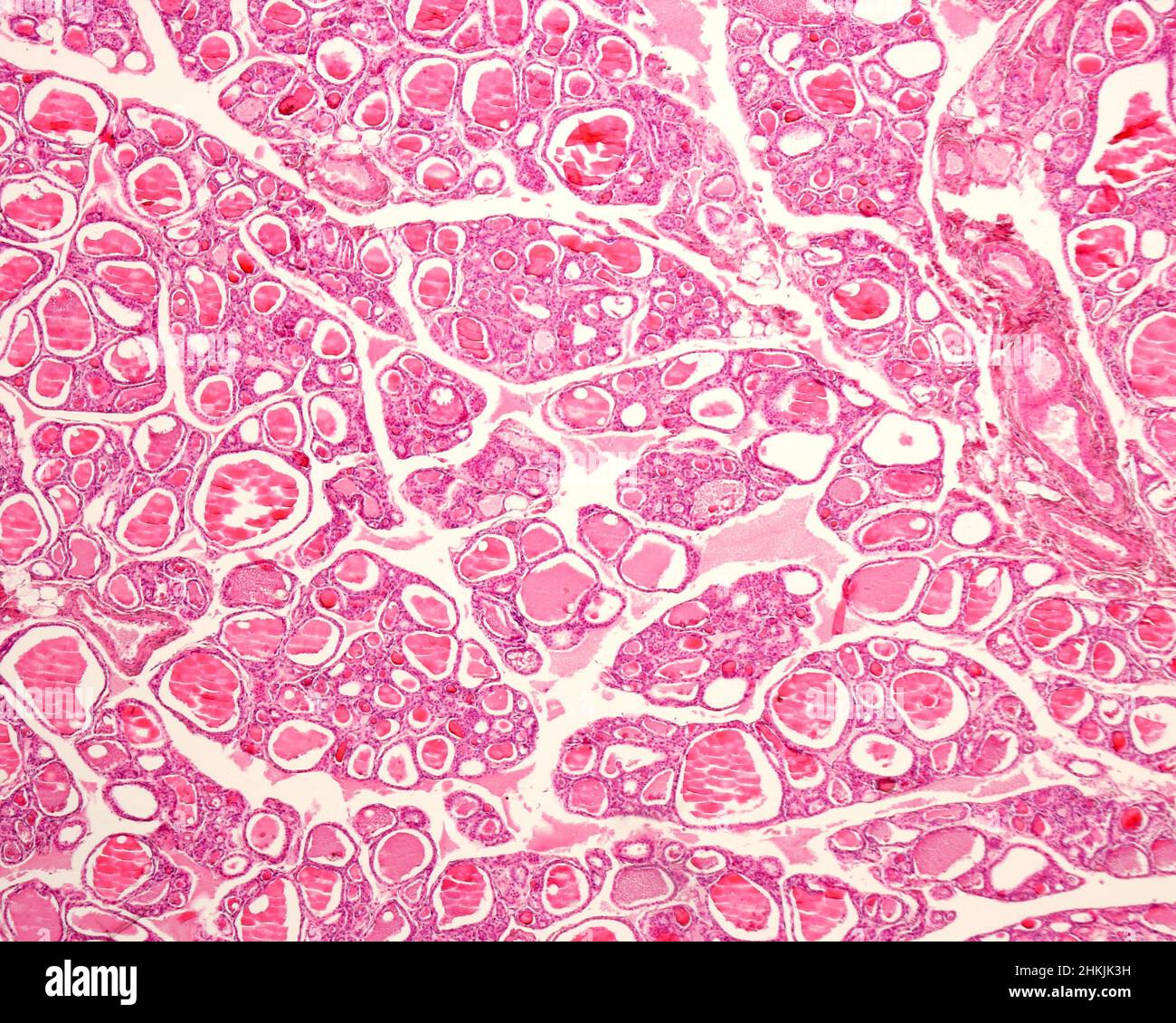 Human thyroid gland, light micrograph Stock Photo - Alamy
